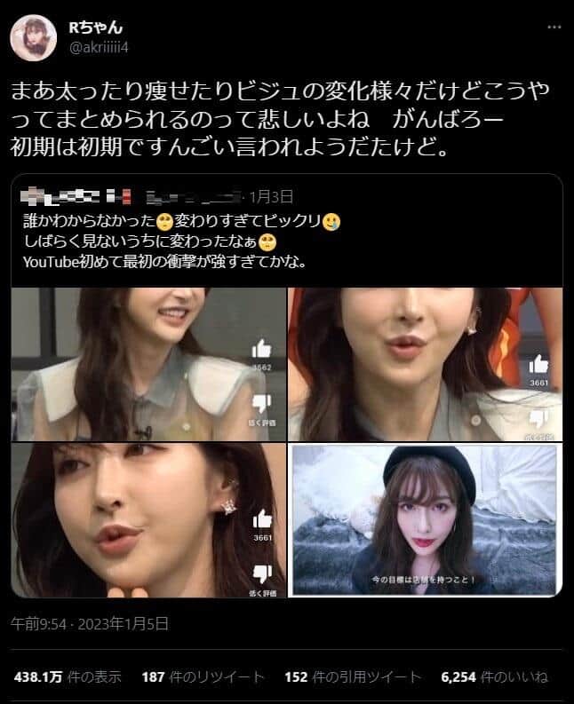 「誰かわからなかった」 整形公表YouTuber、容姿比較に嘆き「こうやってまとめられるの悲しい」: J-CAST ニュース